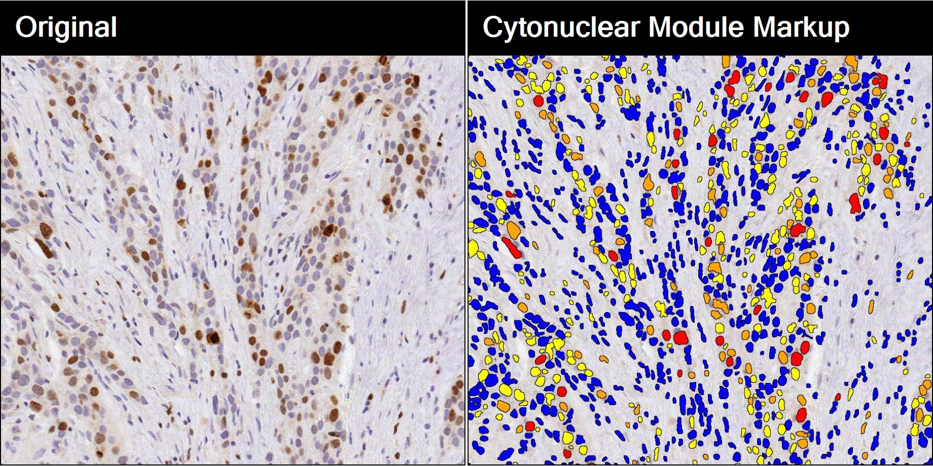 HALO™ - 顶尖数字病理图像分析平台 | 上海新振仪器设备有限公司