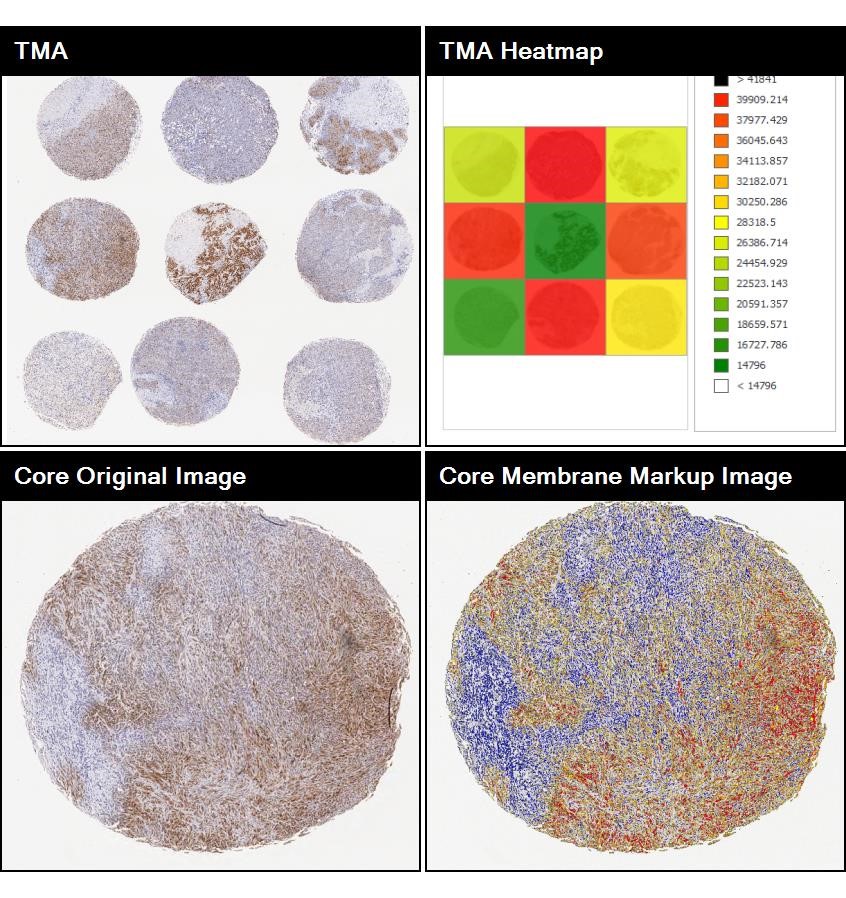HALO™ - 顶尖数字病理图像分析平台 | 上海新振仪器设备有限公司