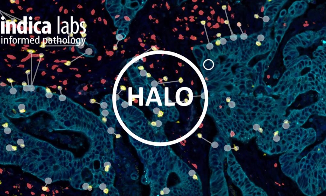 HALO™ - 顶尖数字病理图像分析平台 | 上海新振仪器设备有限公司