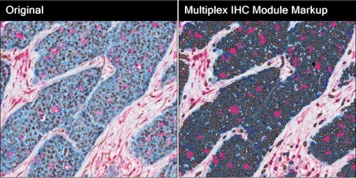 HALO™ - 顶尖数字病理图像分析平台 | 上海新振仪器设备有限公司