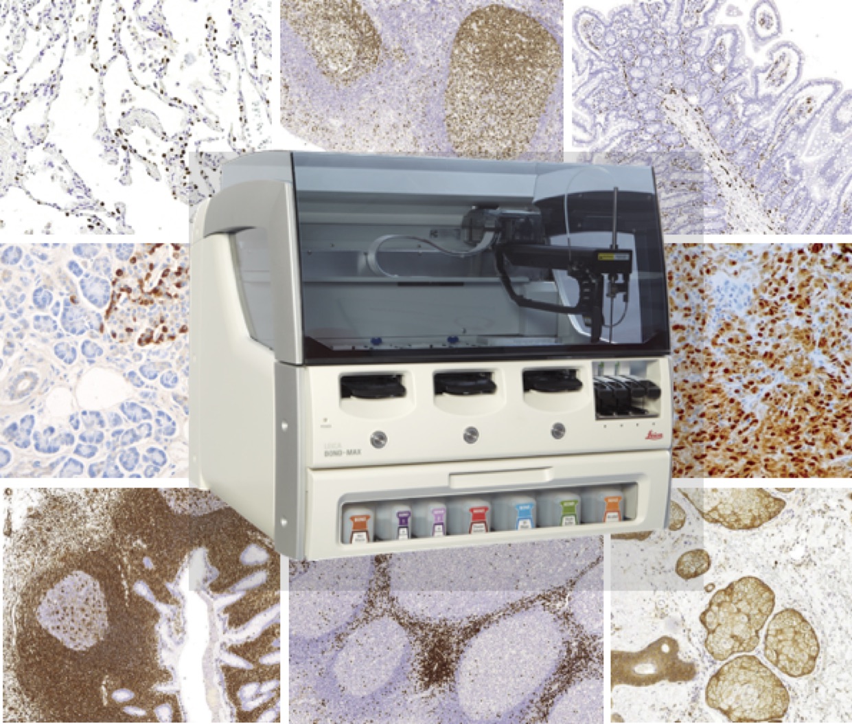 IHC和ISH 免疫组化染色机和试剂 归档 | 上海新振仪器设备有限公司