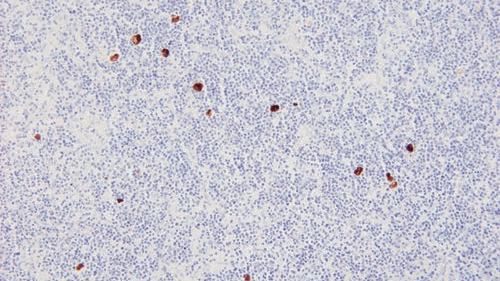 徕卡 BOND EBER 探针 | 上海新振仪器设备有限公司